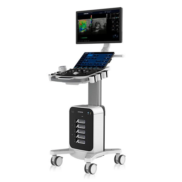 Ultrasonidos: Ultrasonido Chison SonoMax 9